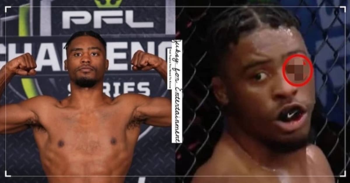 MMA 選手 Mark Martin 比賽打一半「眼睛往下掉」，經紀人：「擤鼻涕導致眼睛爆裂」 JUKSY 街星